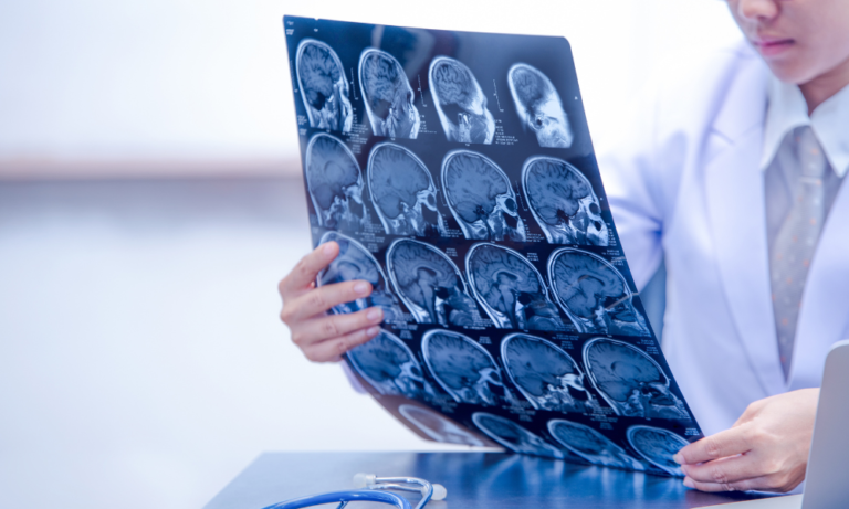 Understanding MRI Scans: Overcoming Fear and Gaining Clarity - Mathilde ...